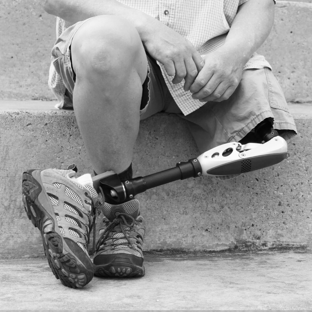 We’re Not Stumped Amputee Categories