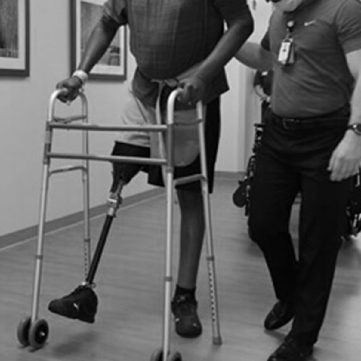 We’re Not Stumped Amputee Categories