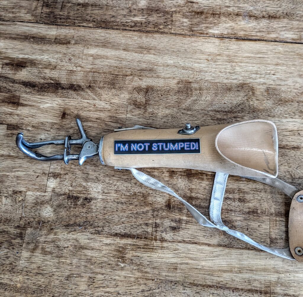 Amputee Stories | Personal Journeys of Limb Loss and Triumph